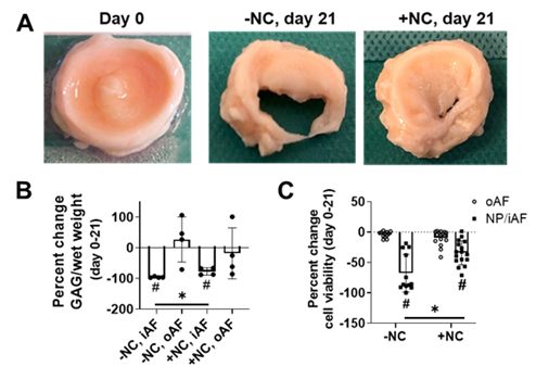 Induced pluripotent stem cell-based therapy for spinal regeneration ...
