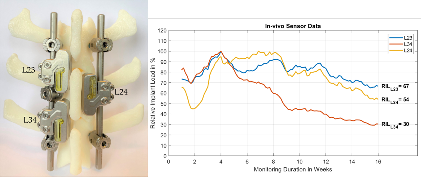 2022 Feasibility of the AO Fracture Monitor for measuring spinal fusion ...