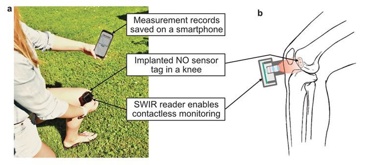 Nitric oxide optical sensors for inflammation monitoring (NIOXIS)