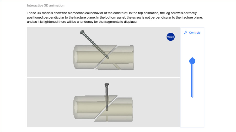 AO Surgery Reference, the digital knowledge hub for AO education, is ...