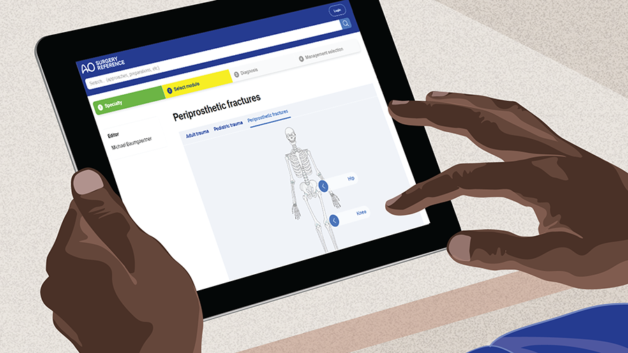 AO Surgery Reference unveils new periprosthetic knee content