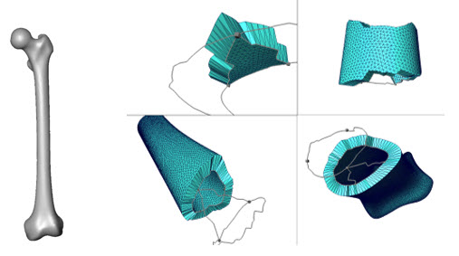 Creation of a statistical form model of the cortical femur with tools ...