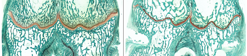 Testing of two different implant concepts for growth plate modulation ...