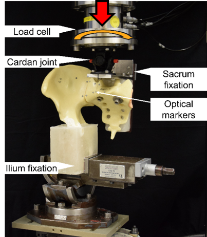 Biomechanical evaluation of a new concept for screw-in-screw fixation ...