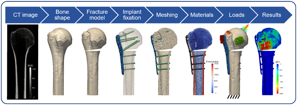 Predicting patient-specific mechanical failure of proximal humerus fracture plating with ...