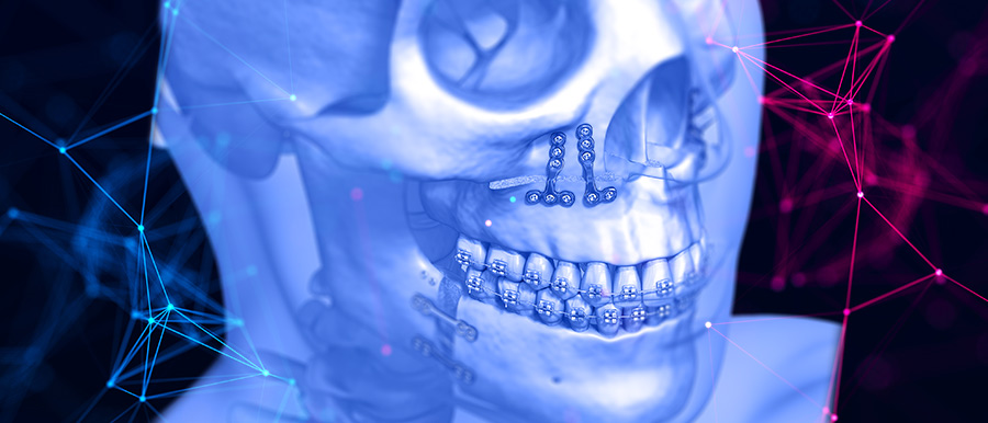Computer-Assisted Craniomaxillofacial Surgery System