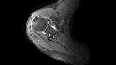 AO Sports NA Masters Course - Management of Complex Shoulder Pathologies