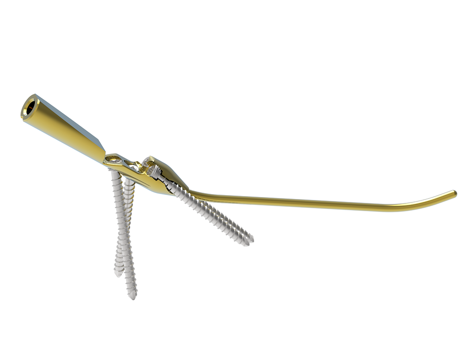 Distal Radius Intramedullary Nail (DRIM-Nail) for the fixation of ...