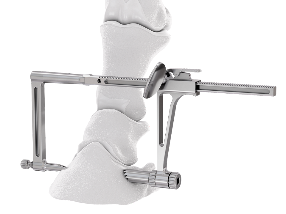 Veterinary Screw Targeting Clamp (STC)