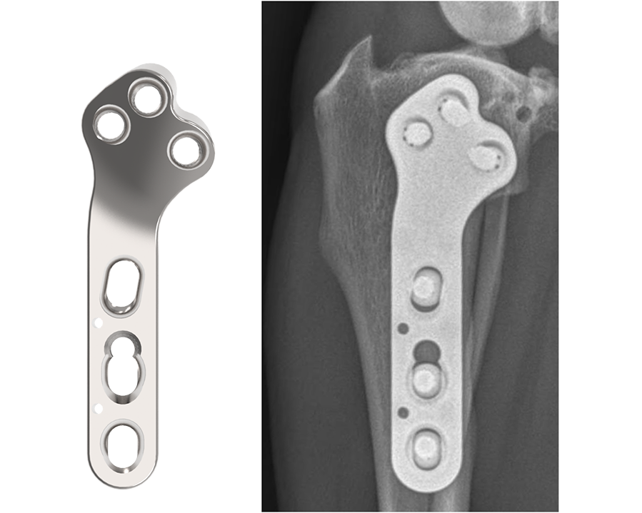 3.5 mm TPLO Plate with Advanced Radial Compression (ARC)