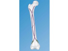 Elastic Nail in Titanium (TEN) and Steel (STEN)