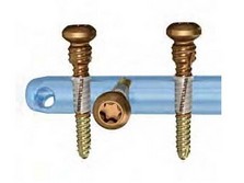 Angular Stable Locking of Intramedullary Nails (ASLS) A new system