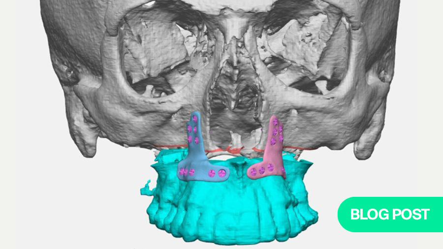 Mandible And Maxilla