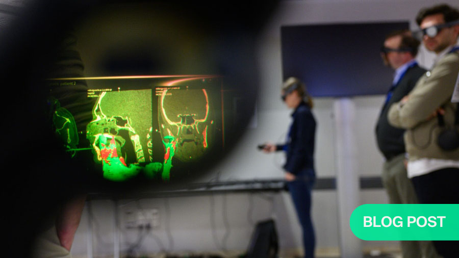Digital Workflows Elevate CMF Surgery: VSP, 3D Modeling and AR Explained