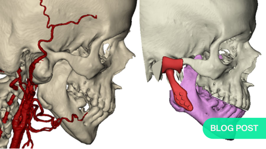 TMJ surgery complications: practical prevention strategies for safer ...