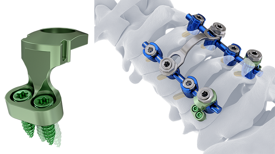 SYMPHONY OCT System—Compartment 2