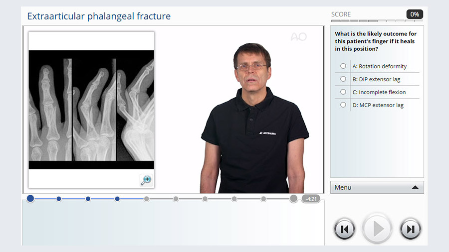 AO Trauma START hand module online