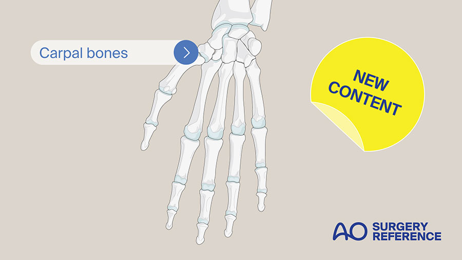 carpal bone hand