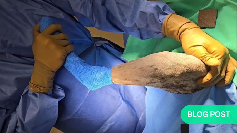 Lateral Suture Stabilization to TPLO