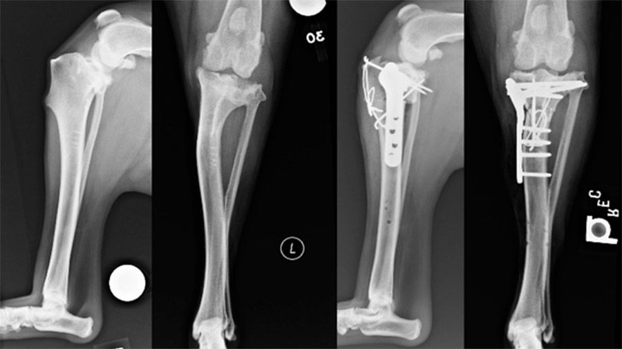 Corrective osteotomy emerges as an effective treatment for more complex ...